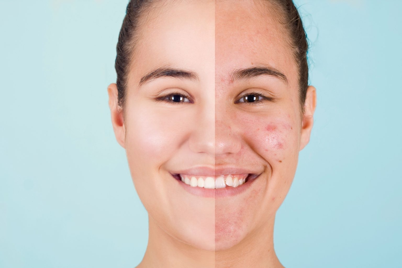 Red Blotchy Skin on Face: What It Is and How to Get Rid of It